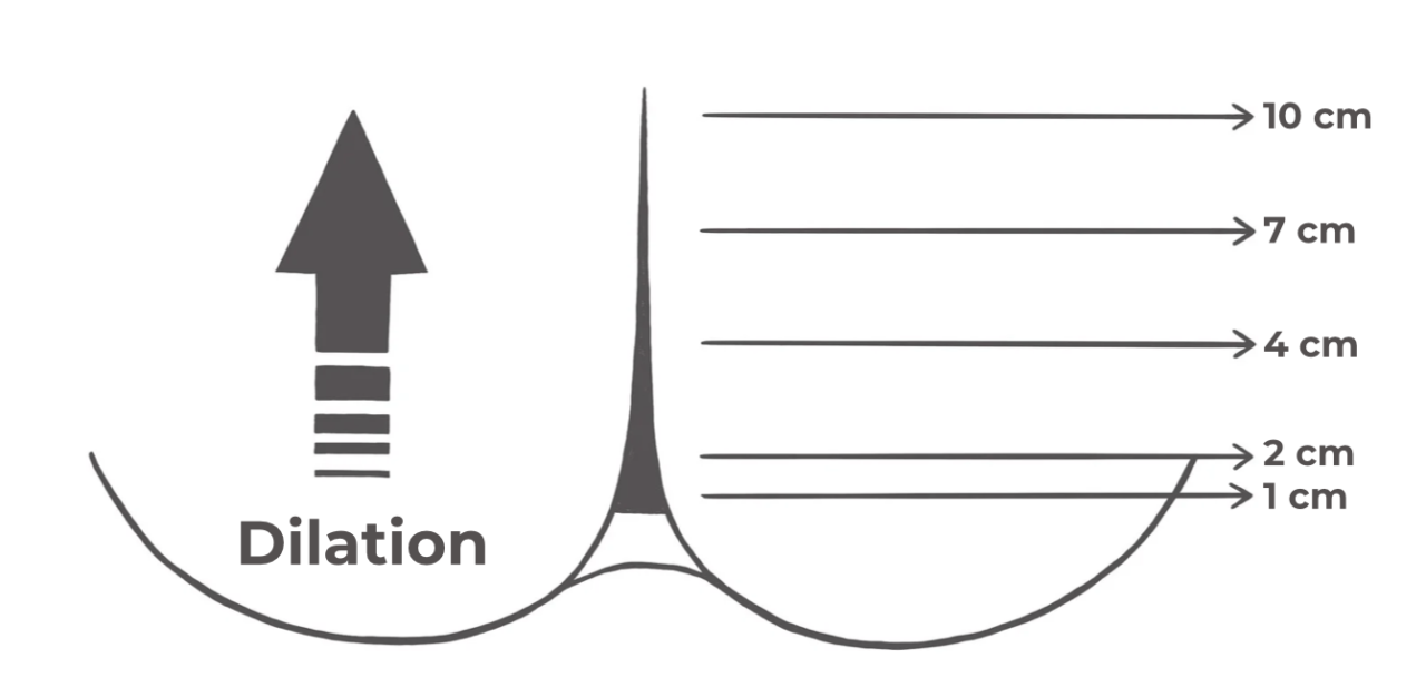 The Purple Line in Labour: Why We Should Call It a Congestion Line ...